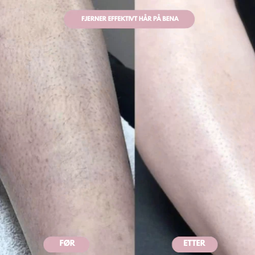 SilkGlide - A Perfect Shave, No Bumps or Nicks - 50% OFF – Evaberry